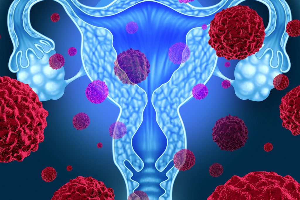 What are the Primary Causes of Cervical Cancer? | HPV Hub, LLC